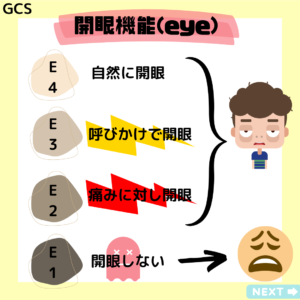 【国試頻出】意識レベルについて 〜JCSとGCSの評価方法〜 ‣ 看護師国家試験対策｜オンライン個別指導｜サキのまなびや